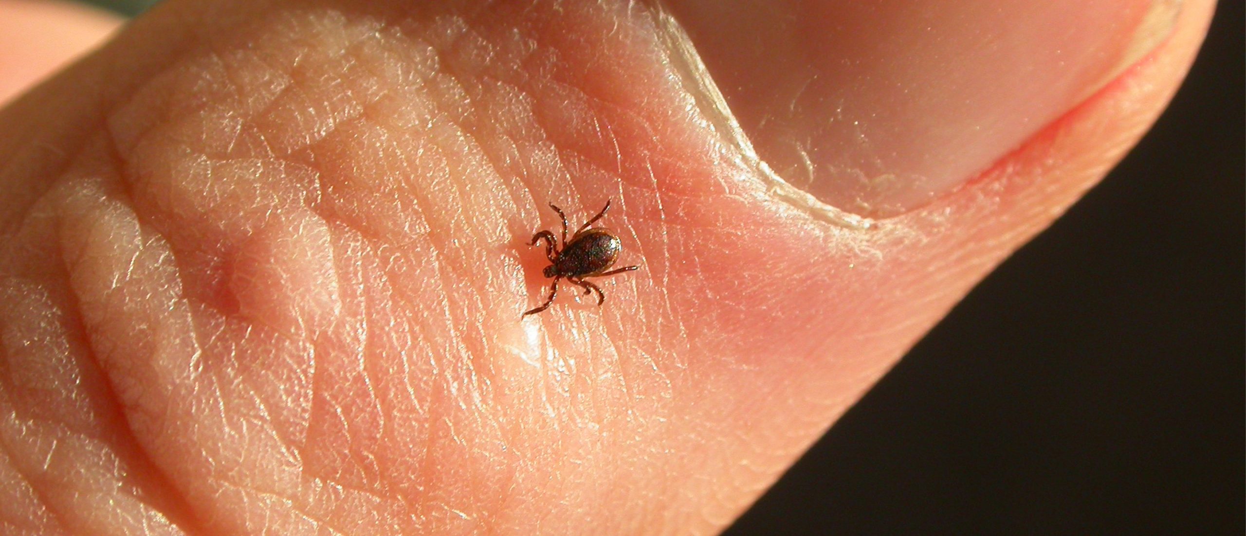 Protect Yourself Against Ticks - The National Wild Turkey Federation
